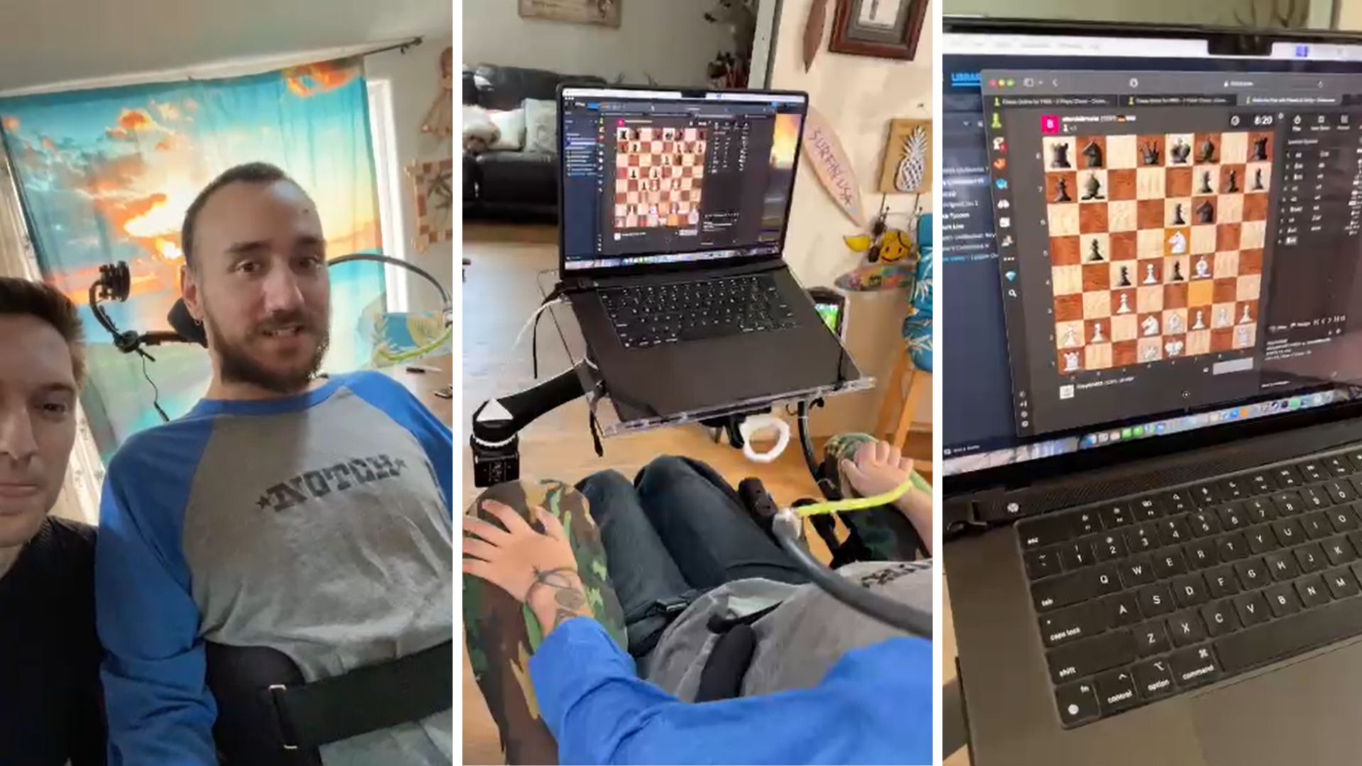 Watch: Neuralink's 'telepathy' breakthrough in human trials ...