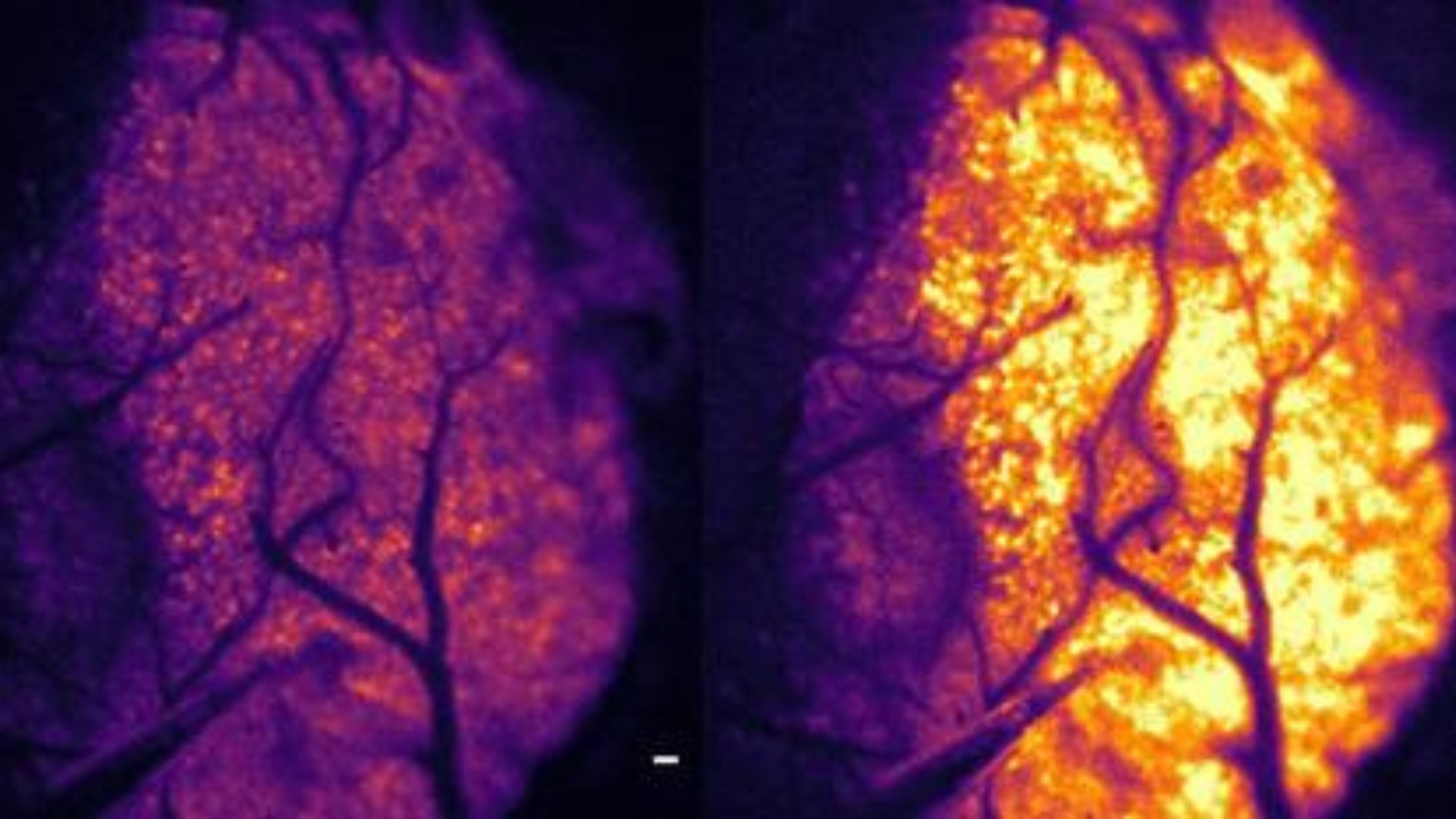 New bioluminescence imaging tech to detect denial of O2 in brain
