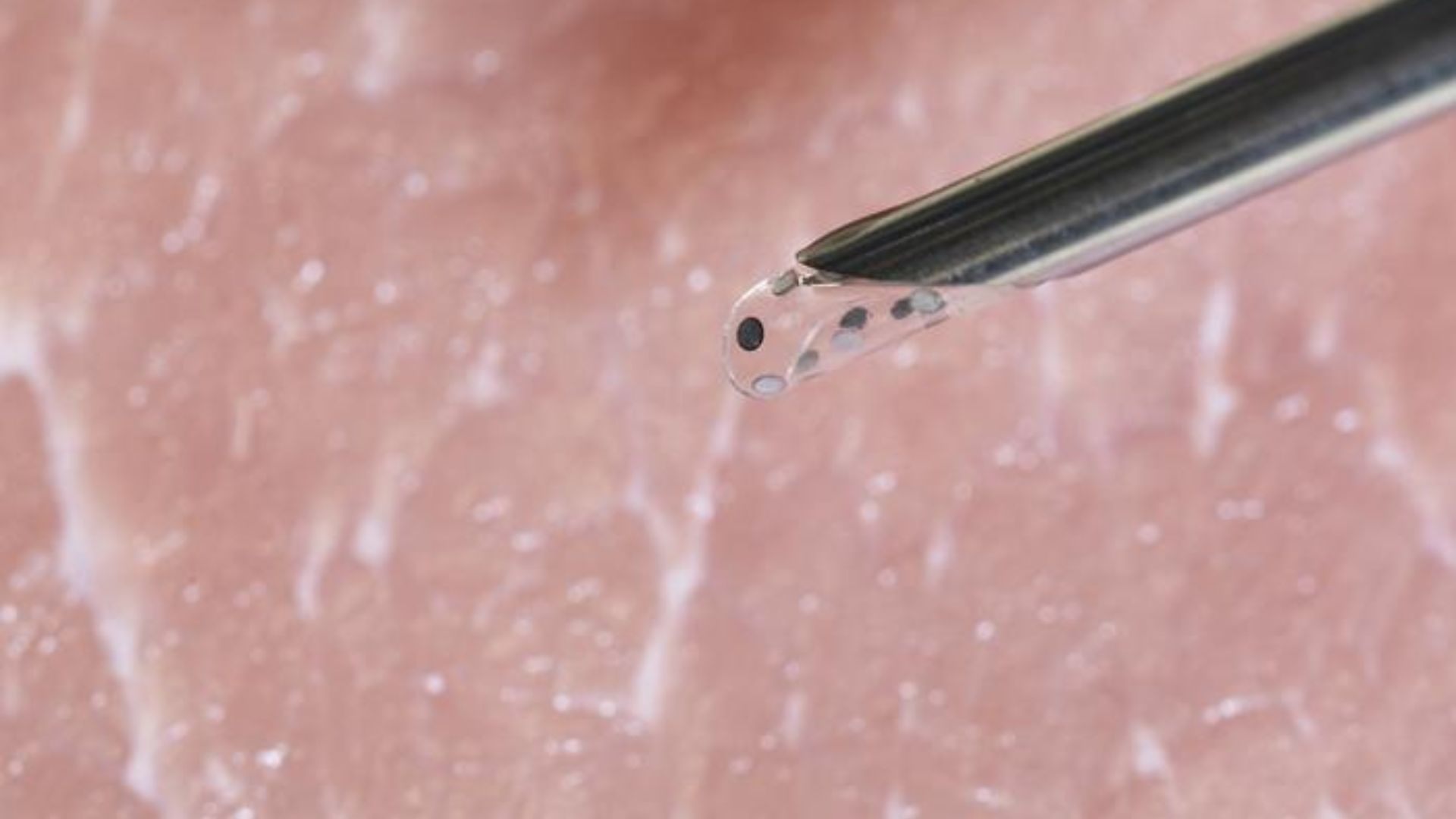 Shape-shifting stickers offer early detection of surgical complications