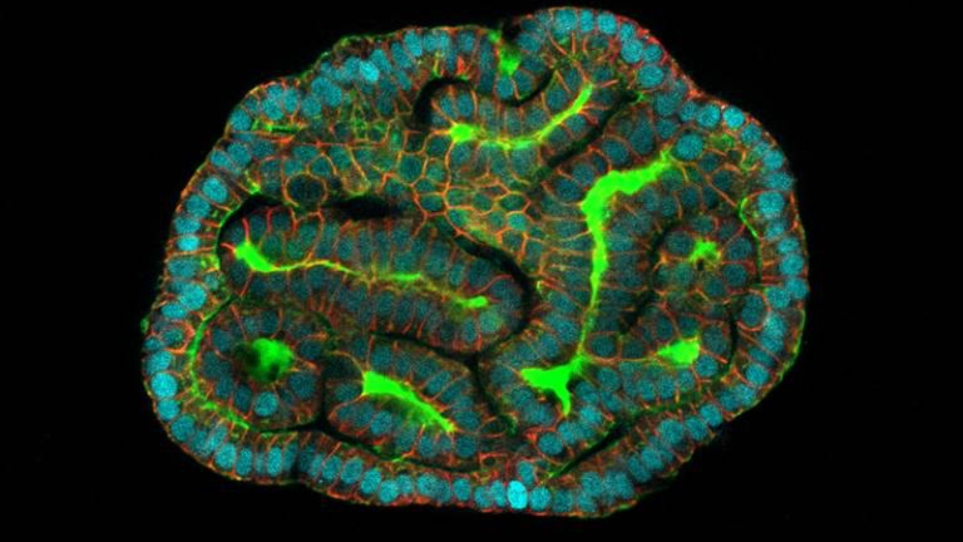 Scientists grow mini lungs, kidneys, intestines from pregnancy fluid