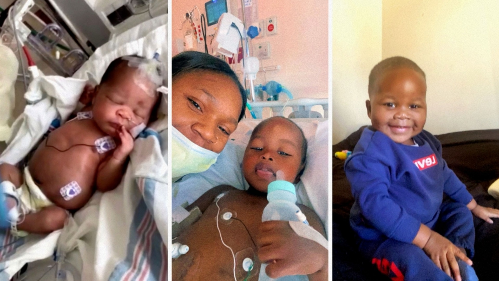 Transplant ready: Formula saves 2-year-old from chronic kidney disease