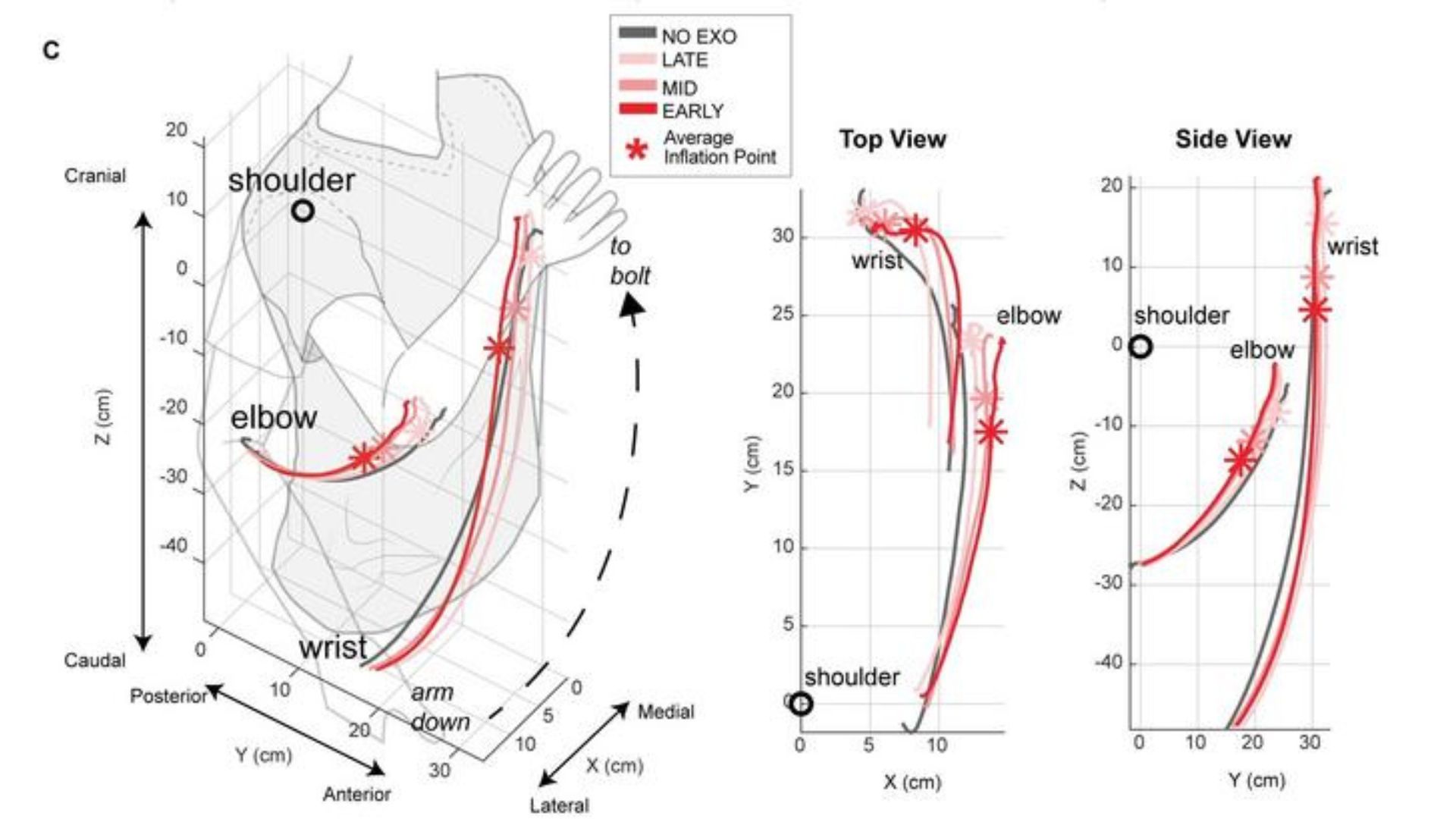 Harvard’s wearable robot reduces shoulder strain during arm lifts