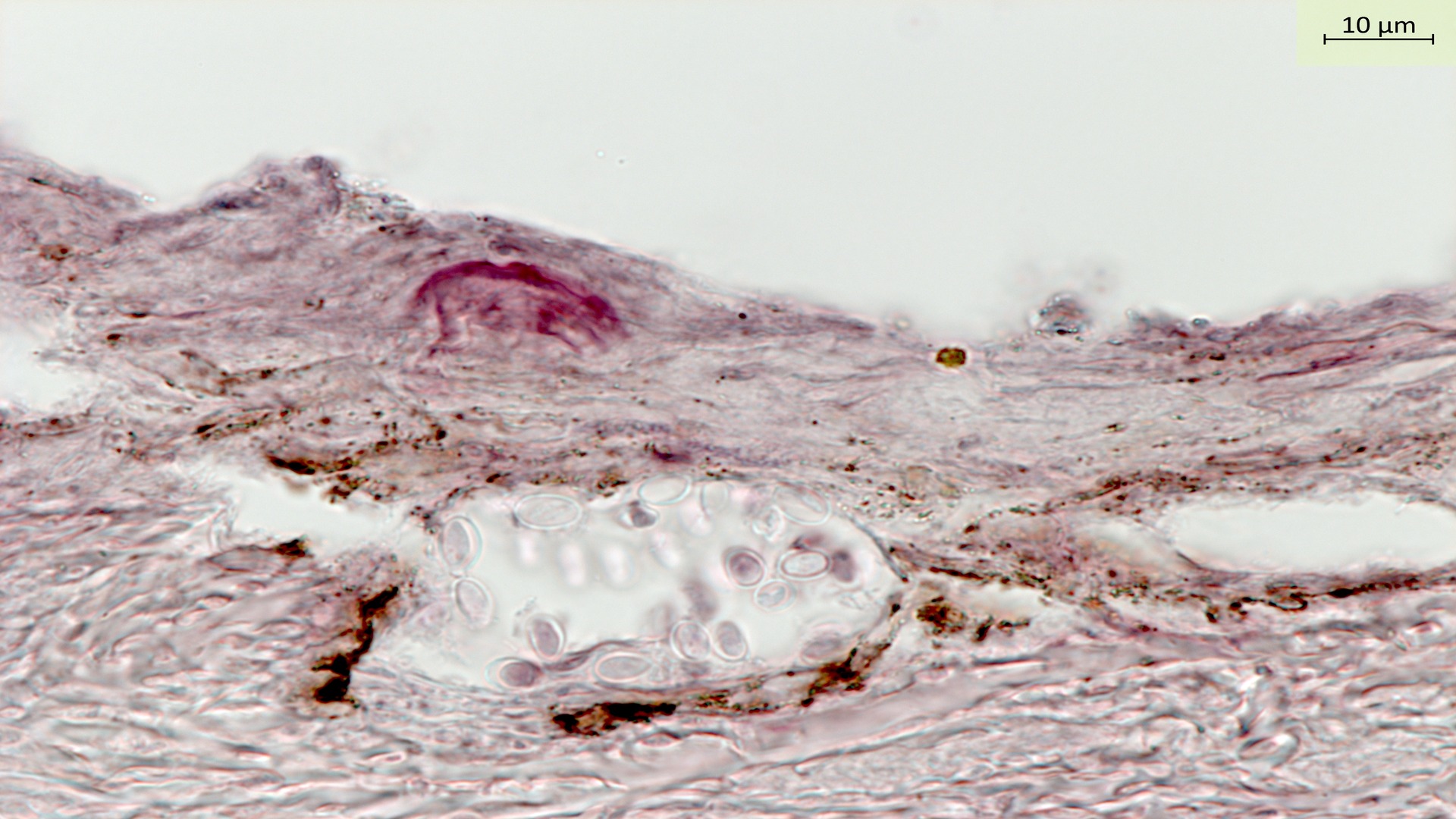 First-ever 3D DNA structure of 52,000-year-old woolly mammoth assembled