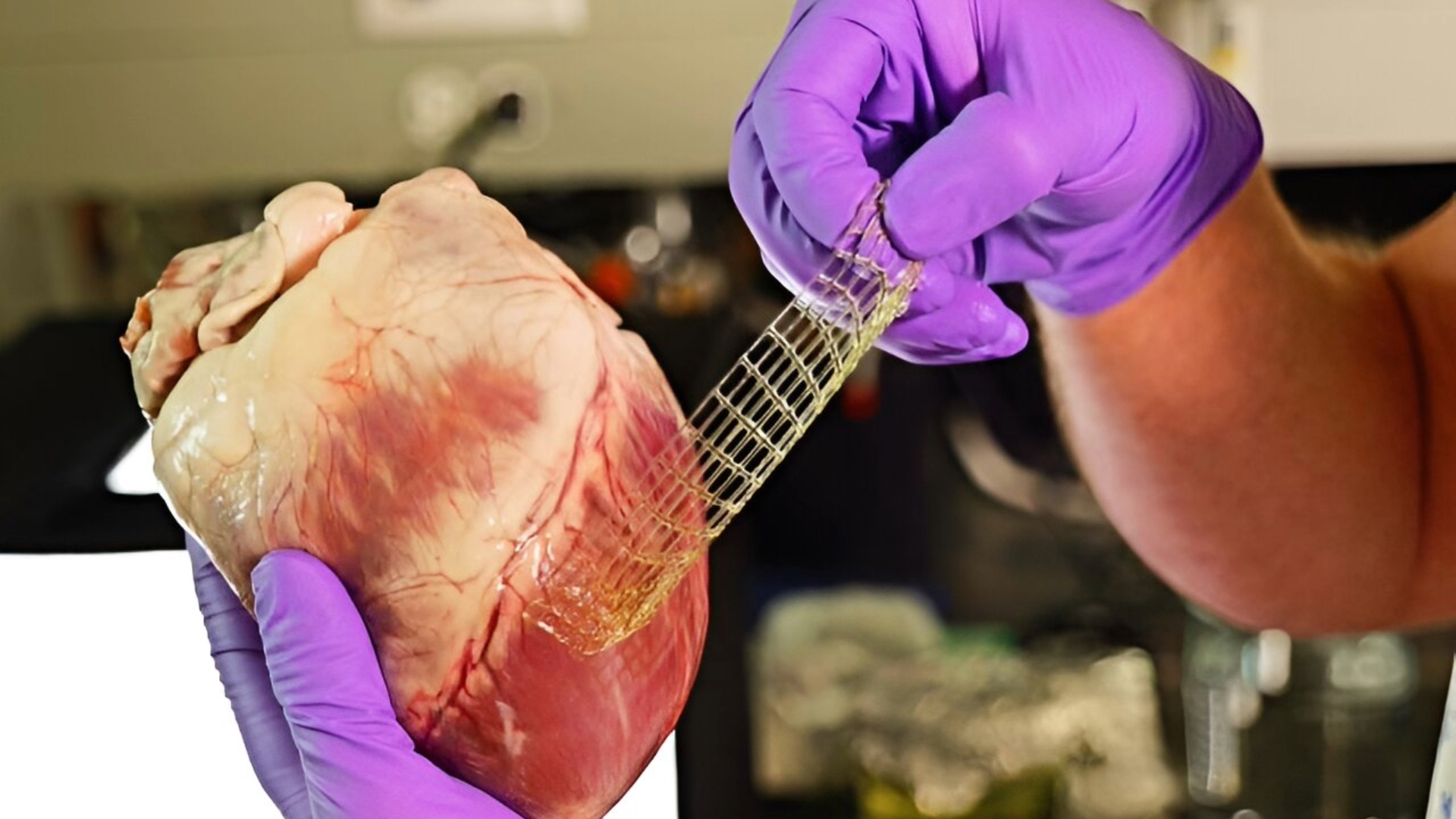 New 3D-printed flexible patches repair heart tissues like a band-aid