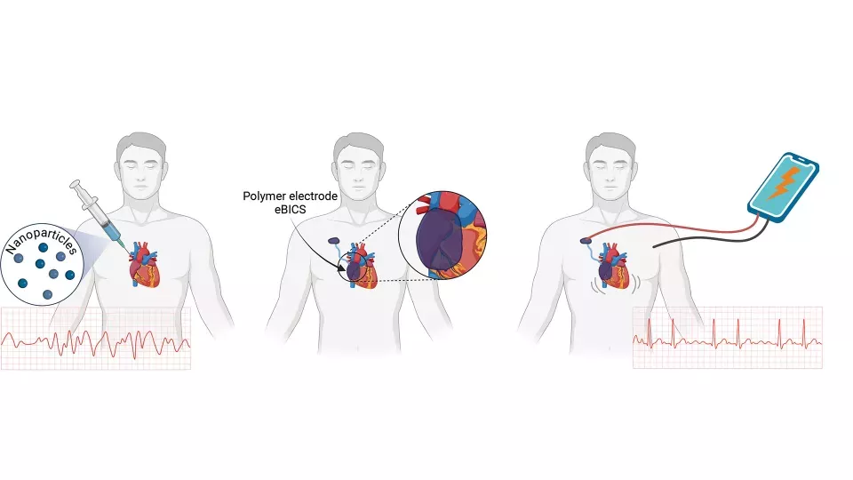 Heart simulator with nanoparticles can temporarily correct arrhythmia