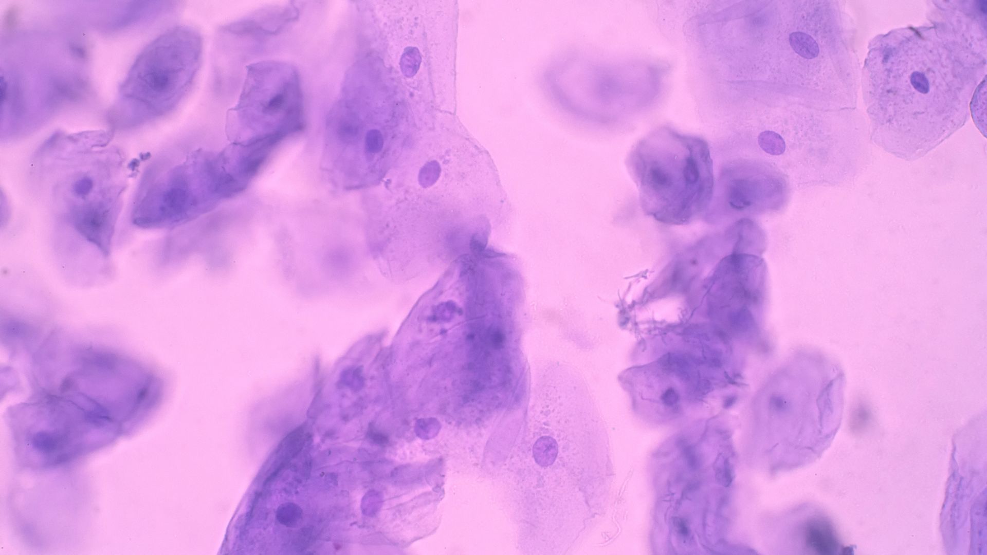 US scientist reveal mouth swab that can gauge your risk of death