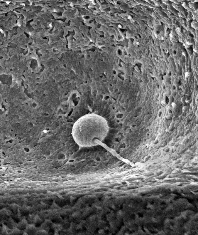 AI-powered discovery identifies lock-and-key process in sperm and egg