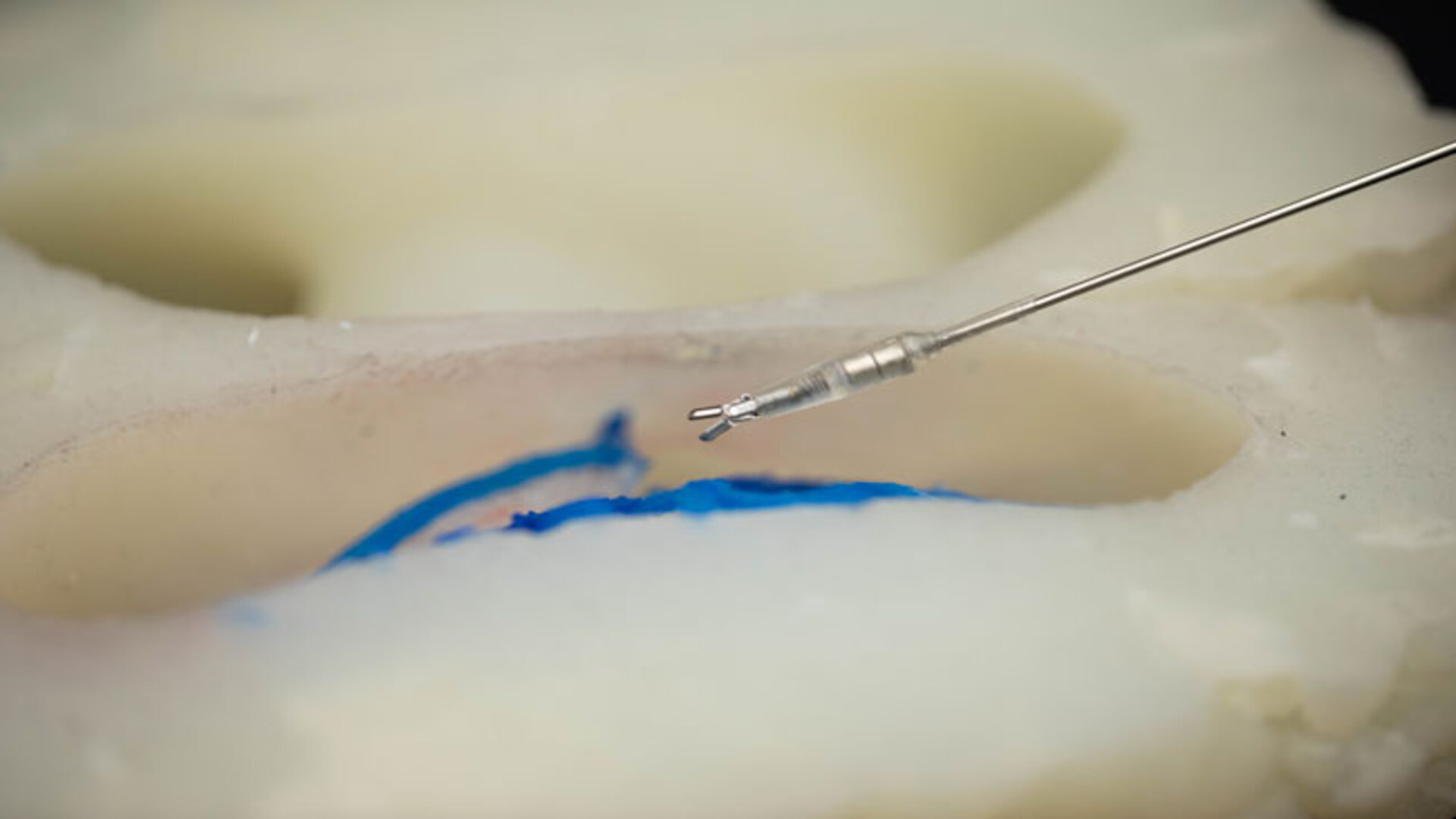 Tiny robotic tools achieve 76% success in scalpel-free brain surgery