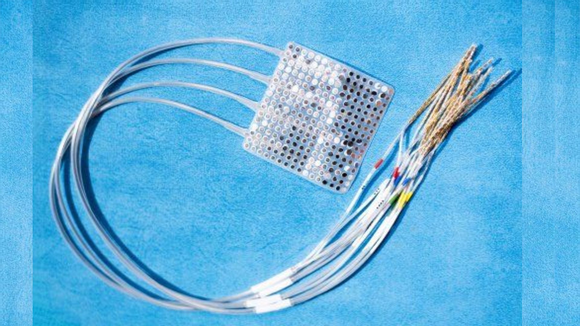 Paralyzed man moves robot arm for record 7 months with new brain chip