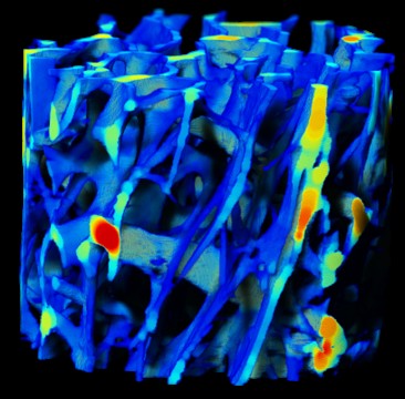 'Sharkitecture': How sharks' cartilage creates unrivaled strength