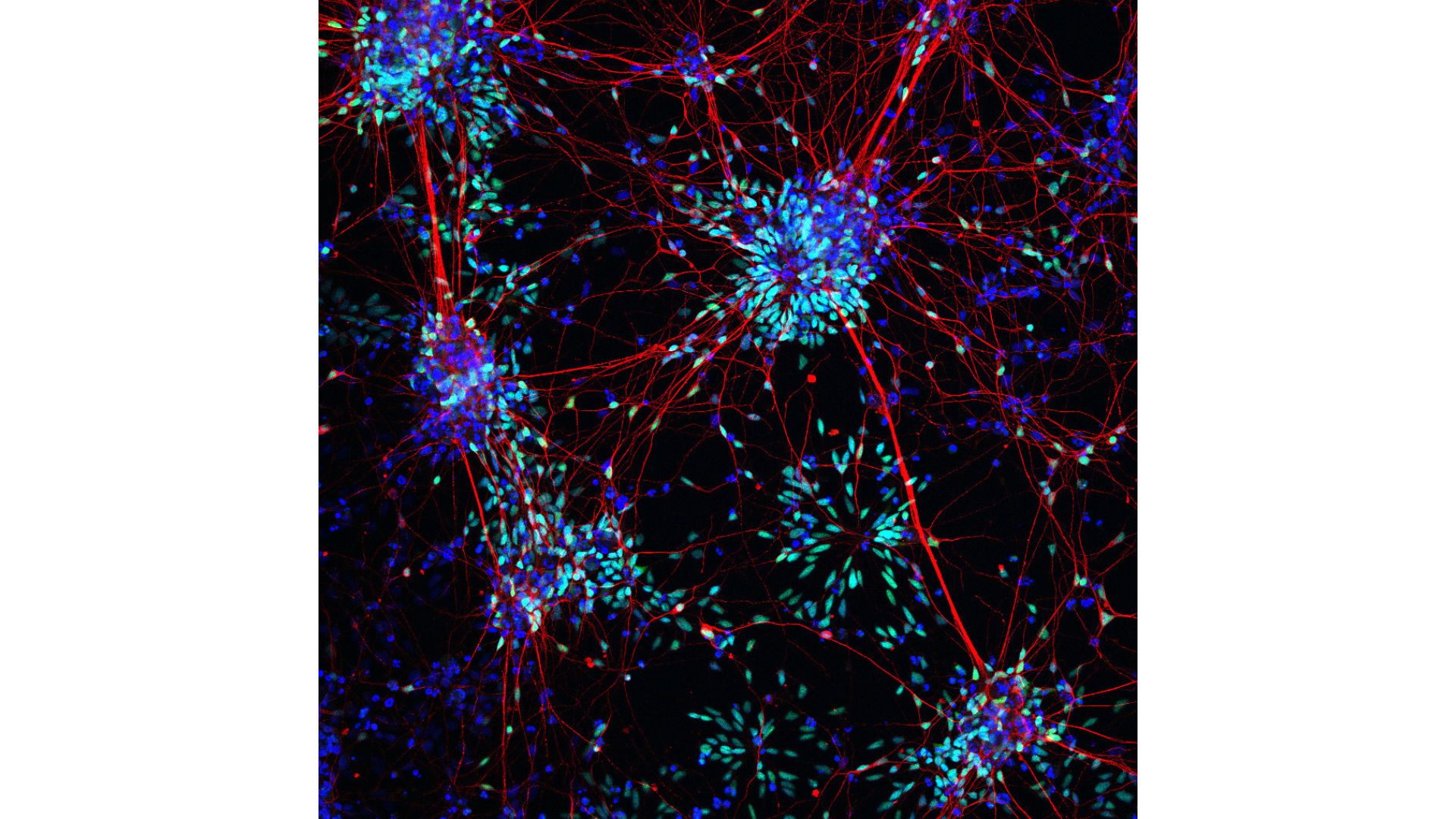 Cortical Labs' CL1 turns living neurons into programmable processors