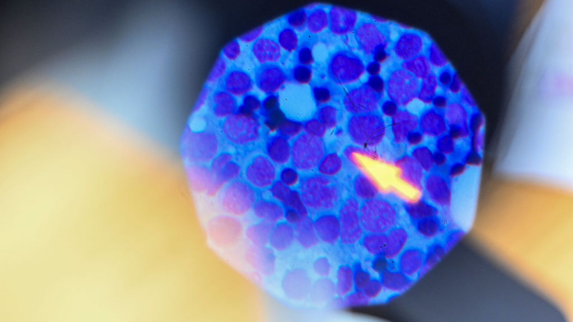 10 deadliest cancers in the world by survival rate