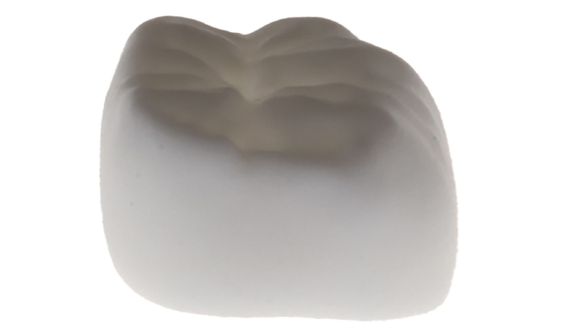 New tech 3D-prints durable zirconia dental crowns in just hours